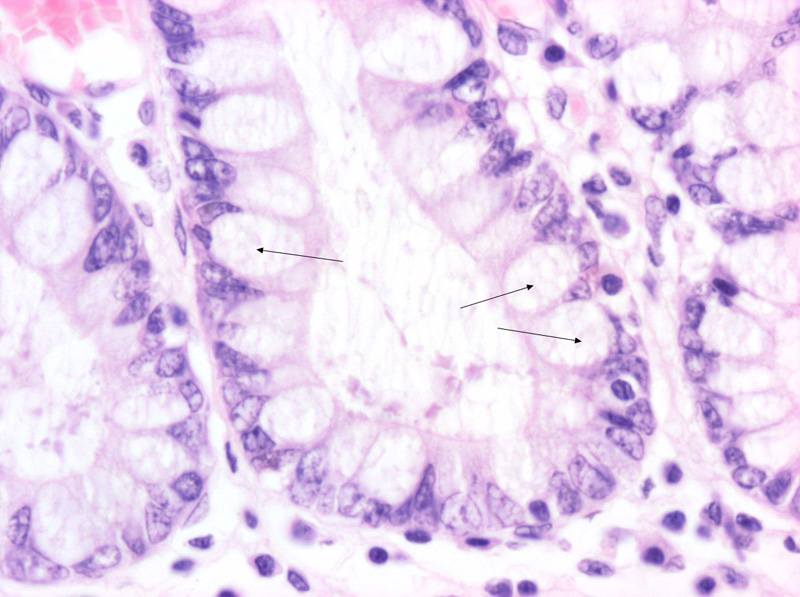 EL INTESTINO GRUESO | Grado en Veterinaria