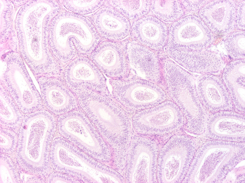 Histologia Do Epididimo Rotulada